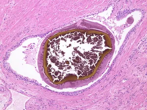 prostate histology normal