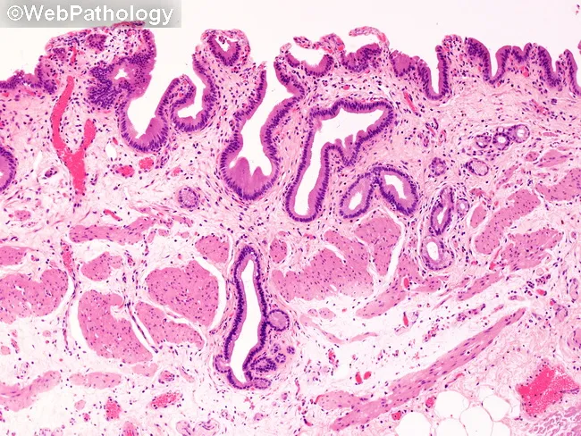 gall bladder slide labeled