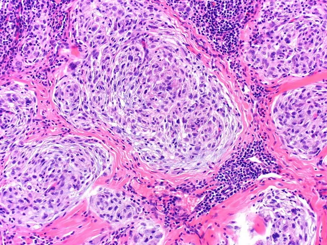 cellular pathology