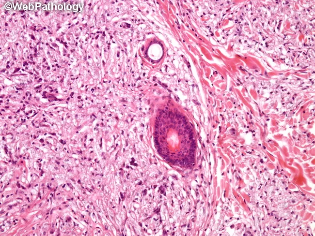 leptocytes