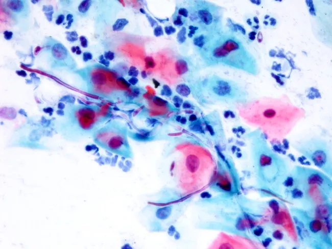 budding yeast candida