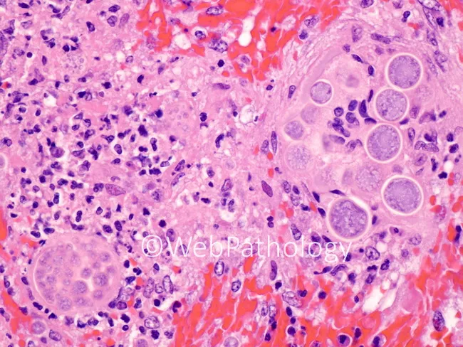 Coccidioides : Microbiology