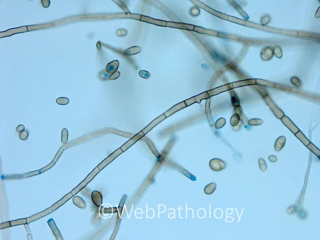 Bipolaris : Fungal Culture