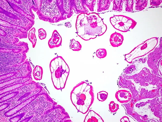 Enterobius vermicularis