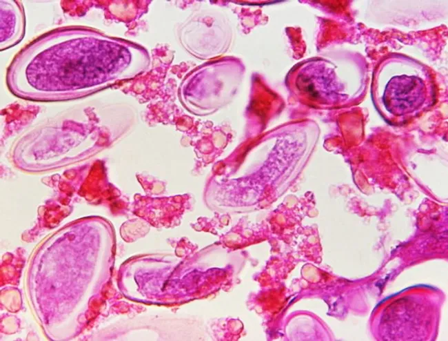 enterobius eggs under microscope