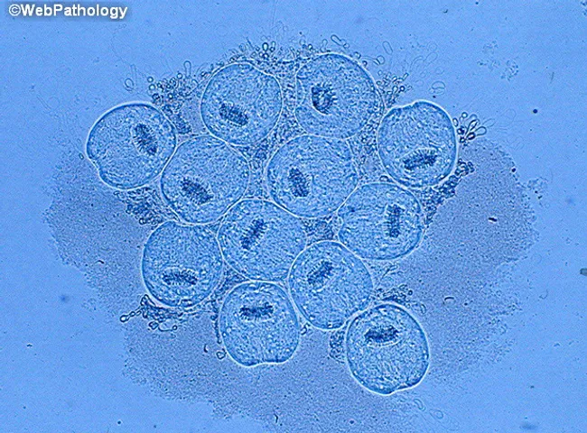 echinococcus granulosus egg under microscope