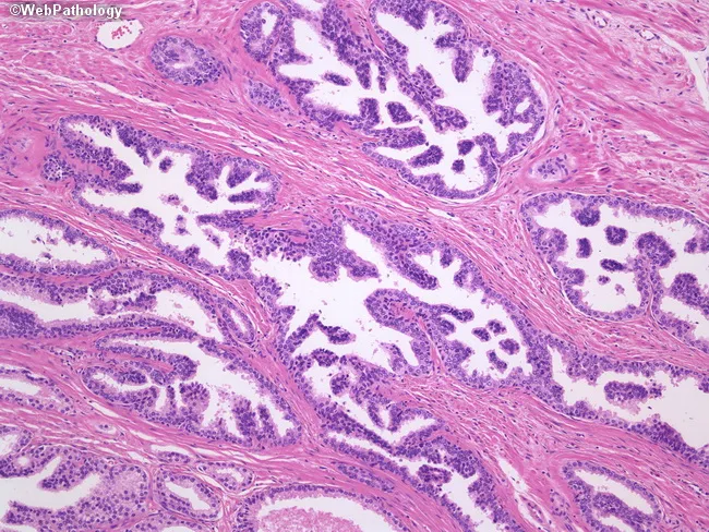 Prostate Gland Slide