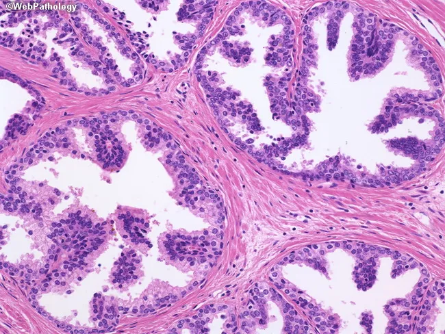 Prostate Gland Slide