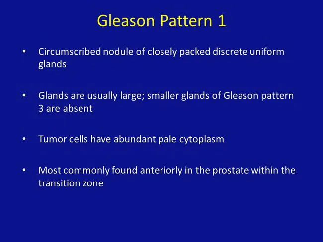 Gleason Pattern 1