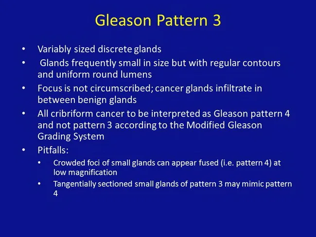 Gleason Pattern 3