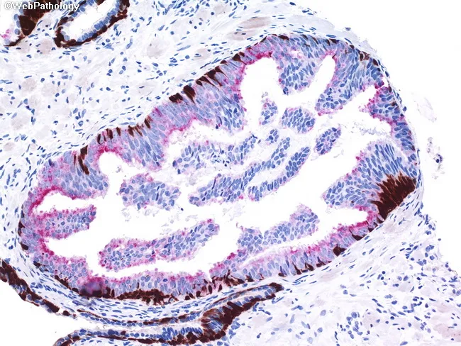 PIN-4 Cocktail in High-grade PIN