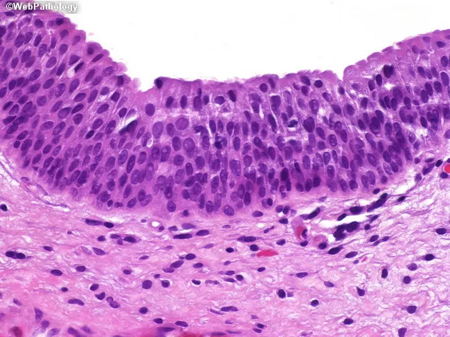 histology bladder