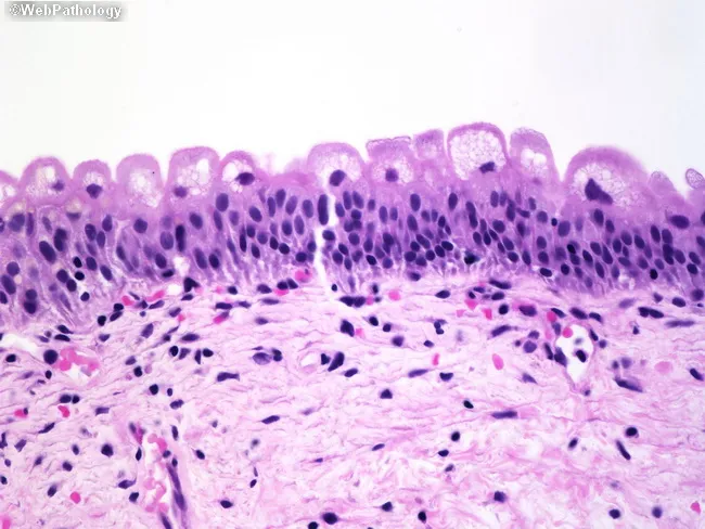 bladder histology normal