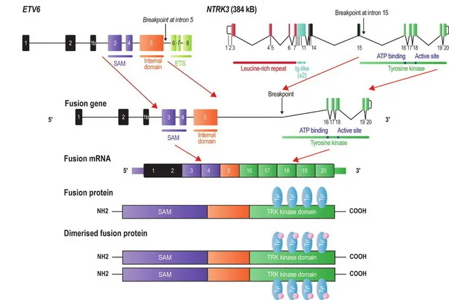 Mesoblastic Nephroma : ETV6-NTRK3 Fusion