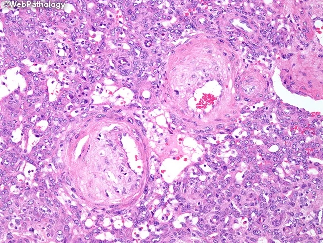 Juxtaglomerular Cells Histology Juxtaglomerular Apparatus