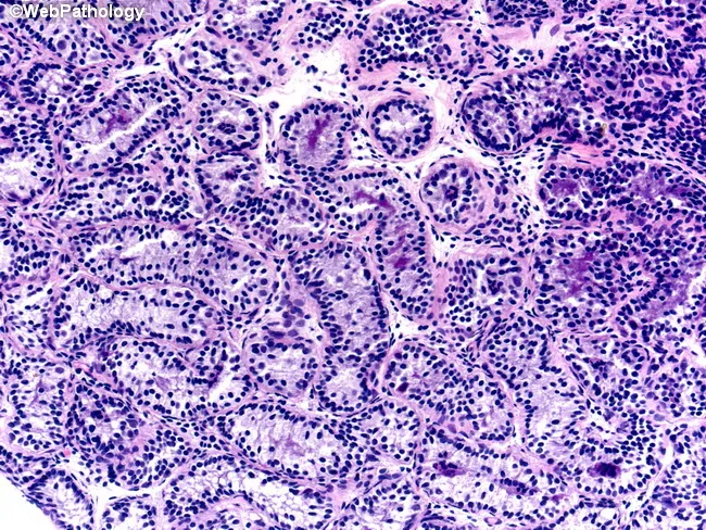 Prepubertal Testis