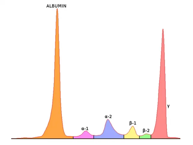 Myeloma : M Component