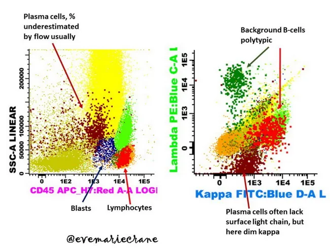 normal plasma cells immunophenotype