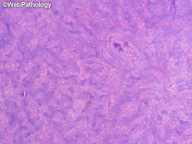 NLPHL : Architectural Patterns