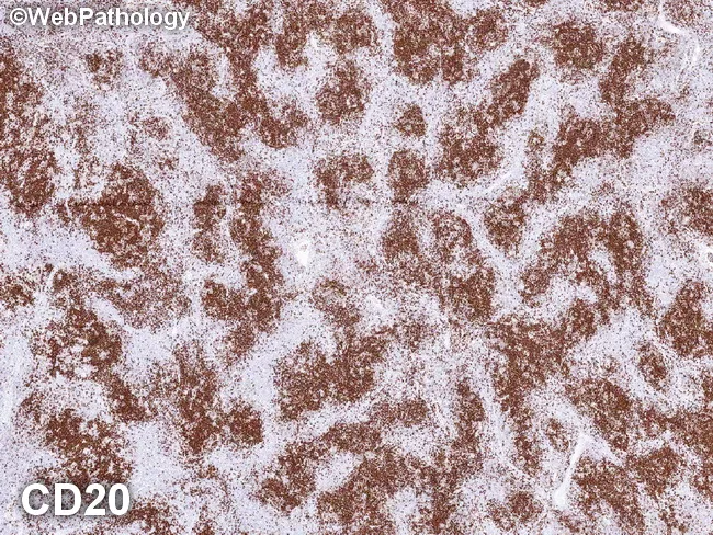 NLPHL : Architectural Patterns