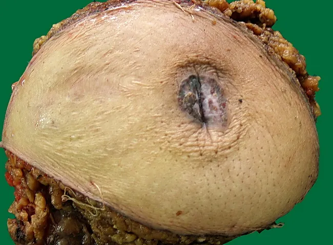 orange texture breast