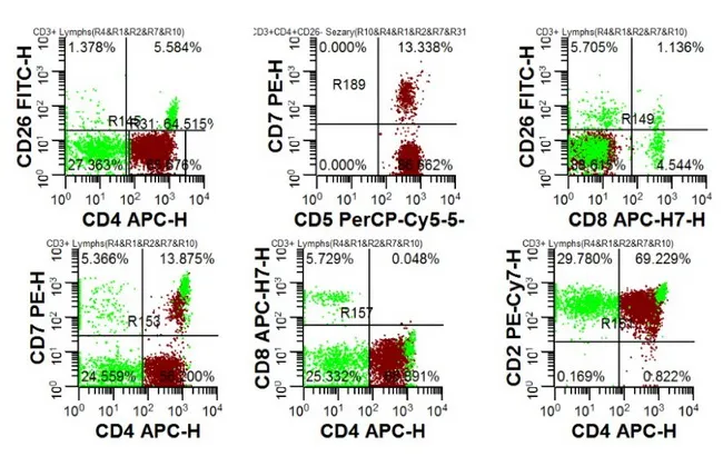 Sezary Syndrome : Immunophenotype