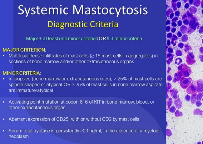 Systemic Mastocytosis : Diagnostic Criteria
