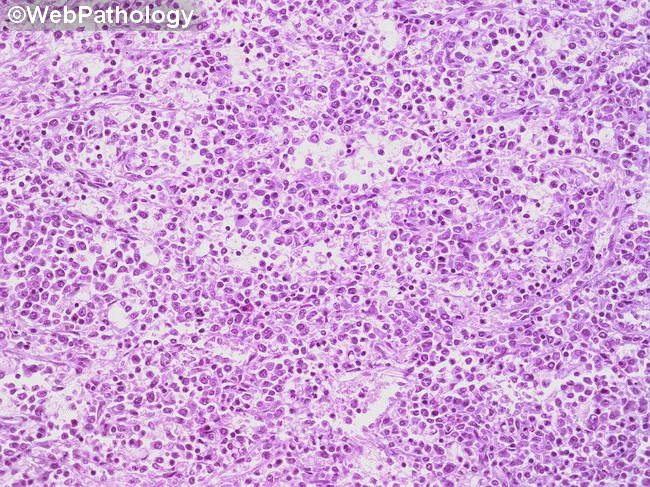 CML in Blast Transformation
