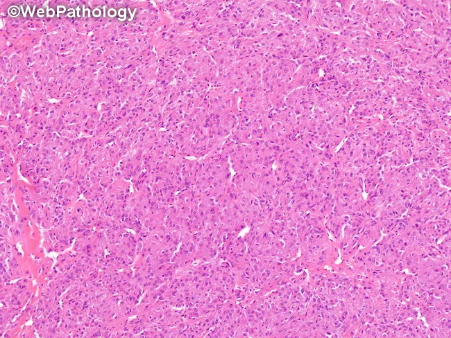 Thecoma : Microscopic Features