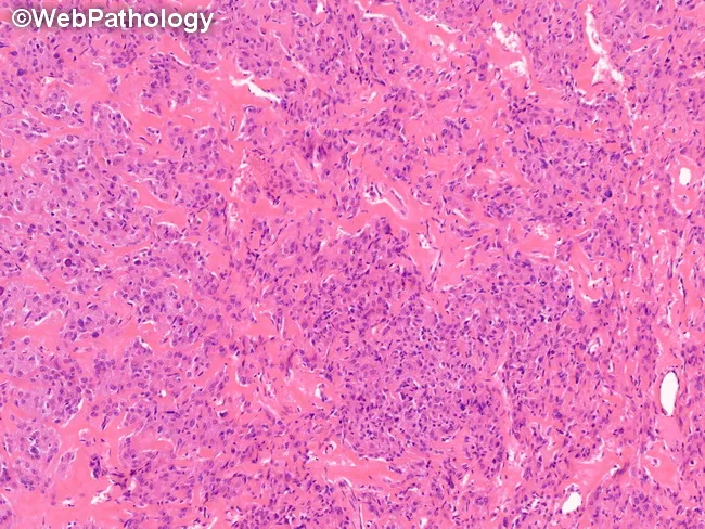 Thecoma : Microscopic Features