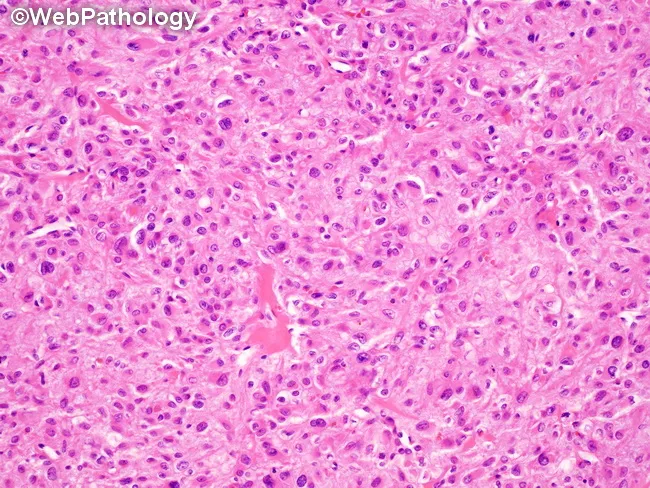 Thecoma : Microscopic Features