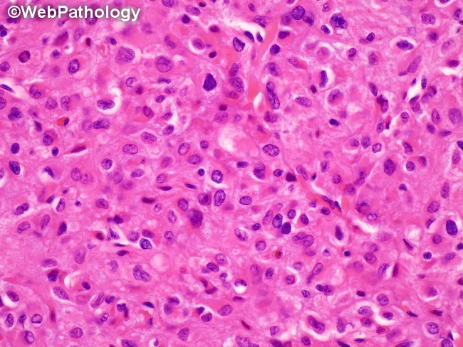 Thecoma Microscopic Features