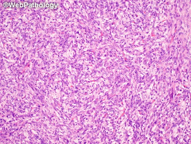 Thecoma : Microscopic Features