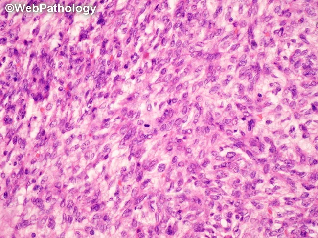 Thecoma : Microscopic Features