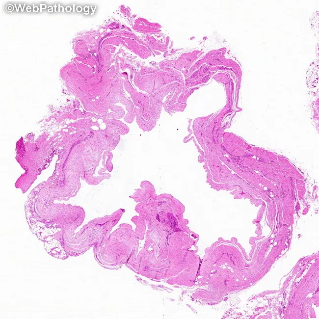 Ganglion: Introduction