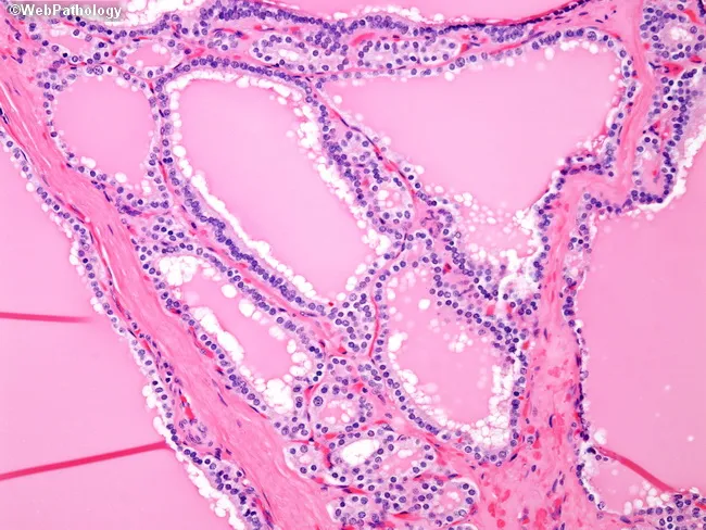 thyroid histology colloid