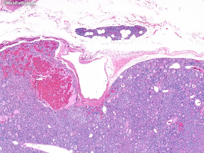 parathyroid slide histology