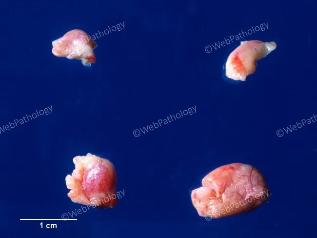 chief cells parathyroid function