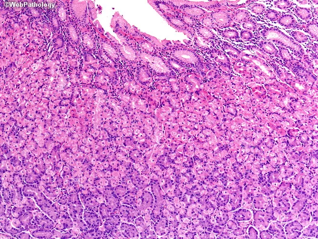 Fundus Of Stomach Histology