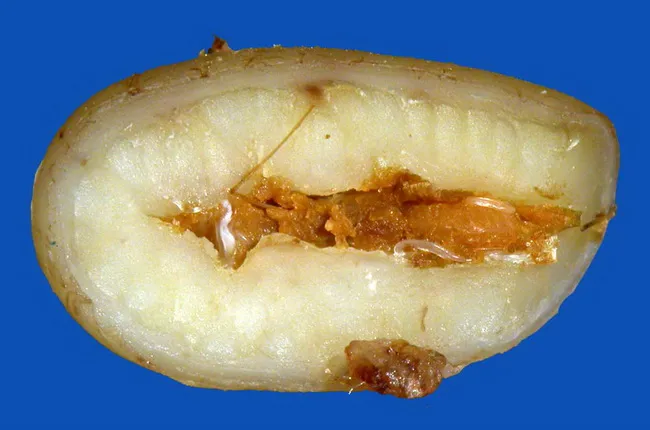 Enterobius vermicularis