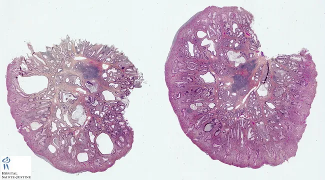 Juvenile Polyp : Microscopic
