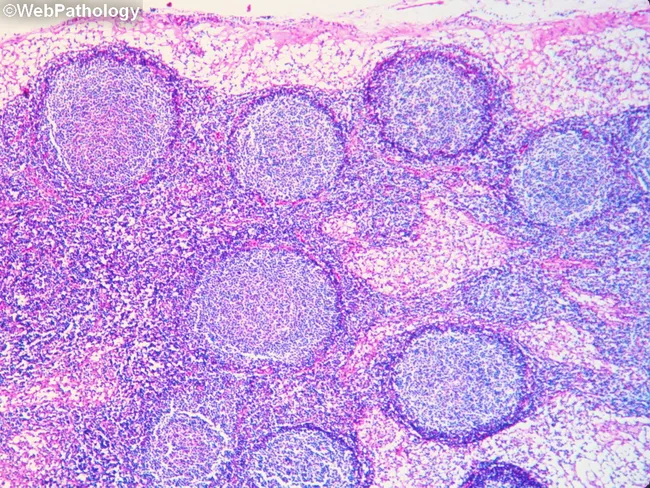 Normal Lymph Node