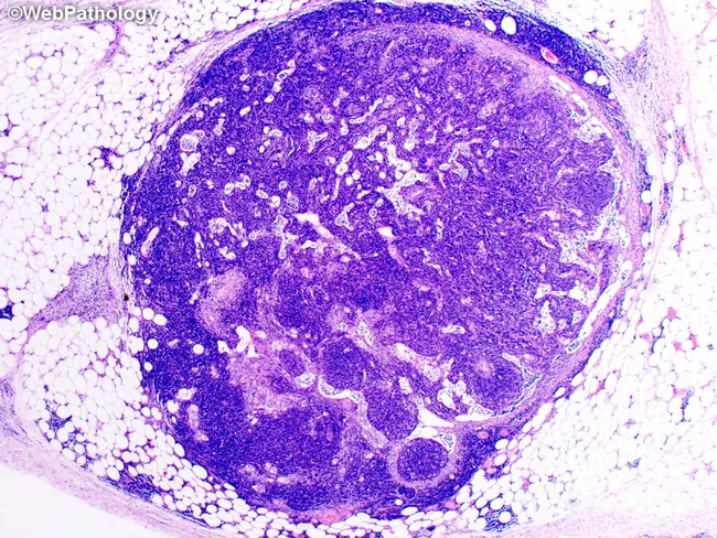 Normal Lymph Node