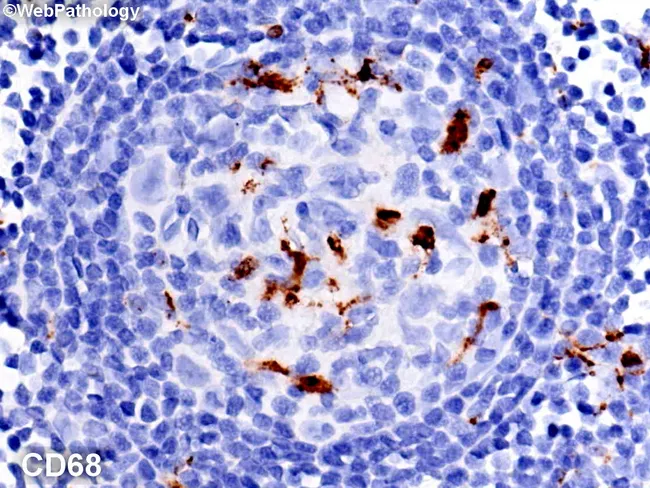 Normal Lymph Node: CD68